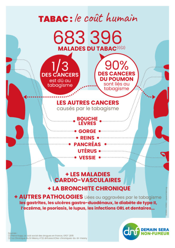 Le tabac, un impact démesuré sur la santé — DNF - demain sera non fumeur